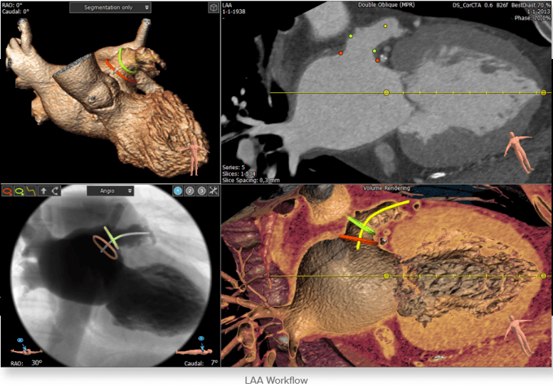 Cutting-Edge interventional cardiology imaging